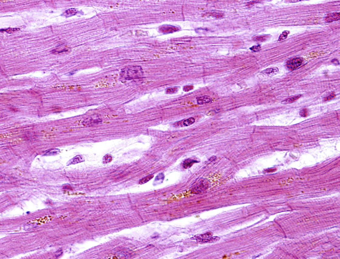 Cardiac Muscle Slide 400x