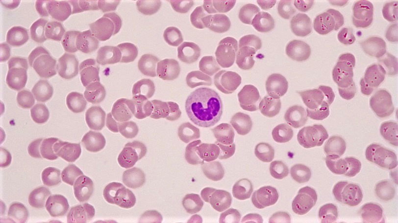 Band Neutrophil
