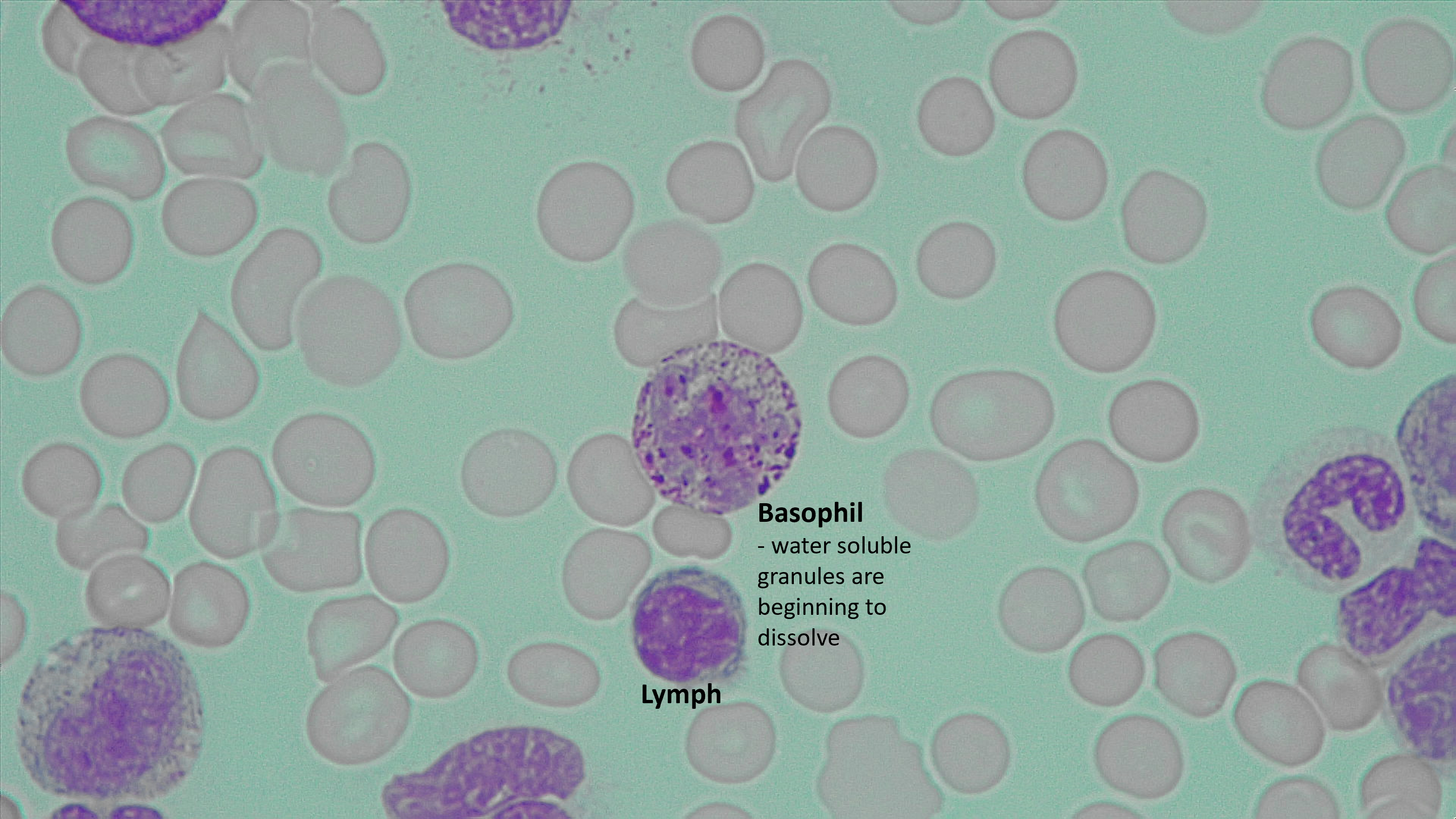 Basophil Under Microscope